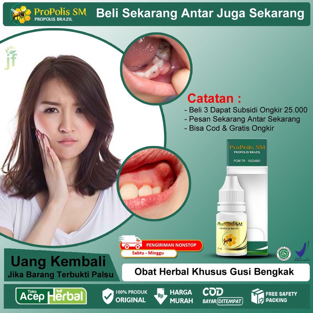 Jual Obat Gusi Bengkak Radang Gusi Perikoronitis Gusi Berdarah Infeksi ...