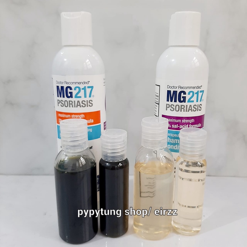 Jual MG217 MG 217 Psoriasis Shampoo Share | Shopee Indonesia