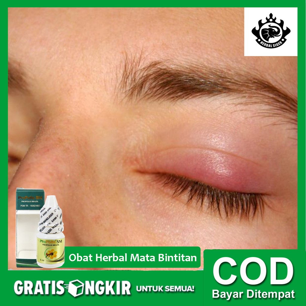 Jual Obat Herbal Mata Bintitan, Benjolan di Kelopak Mata Terlaris ...