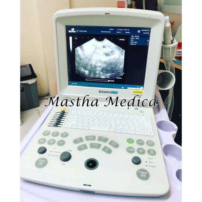 Jual Ultrasonografi USG USG Hewan Diagnostic Ultrasound System Edan DUS ...
