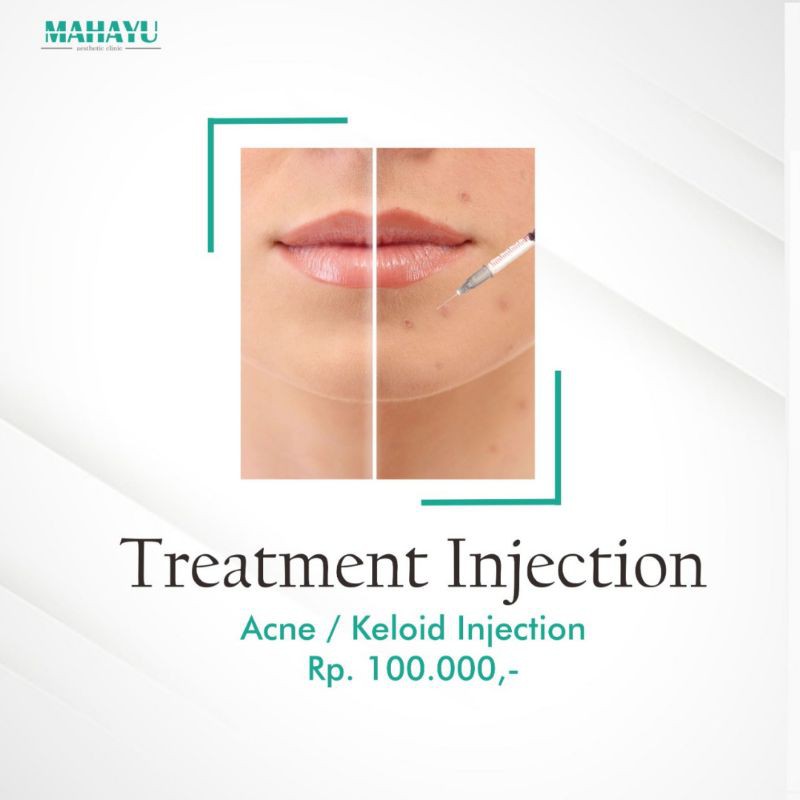 Harga injection acne Terbaru Jan 2025 |BigGo Indonesia
