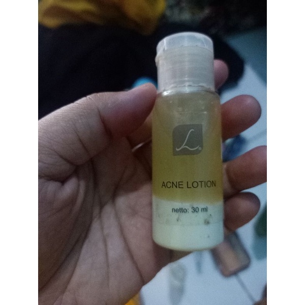 Jual acne lotion larissa | Shopee Indonesia