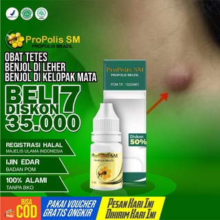 Jual Obat Benjolan - Obat Benjolan Di Leher Benjolan Di kelopak Mata ...