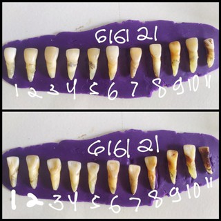 Jual Gigi Asli FKG gigi sulung/ gigi insisive gigi insisif/ gigi ...