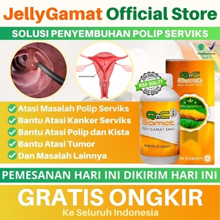Jual Obat Polip Serviks Polip Rahim Obat Benjolan Polip Endometri Tumor ...