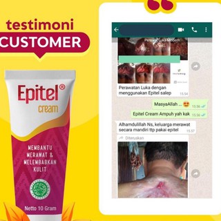 Jual epitel cream 50gr Indonesia|Shopee Indonesia
