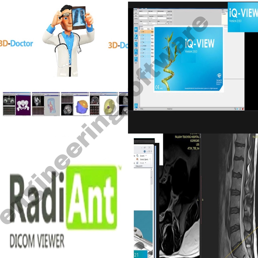Jual [work] IQ-VIEW ALat Mudah digunakan untuk Ahli Radiologi 3D Dokter ...