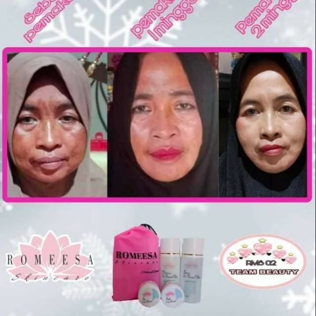 Jual Romeesa skincare | Shopee Indonesia