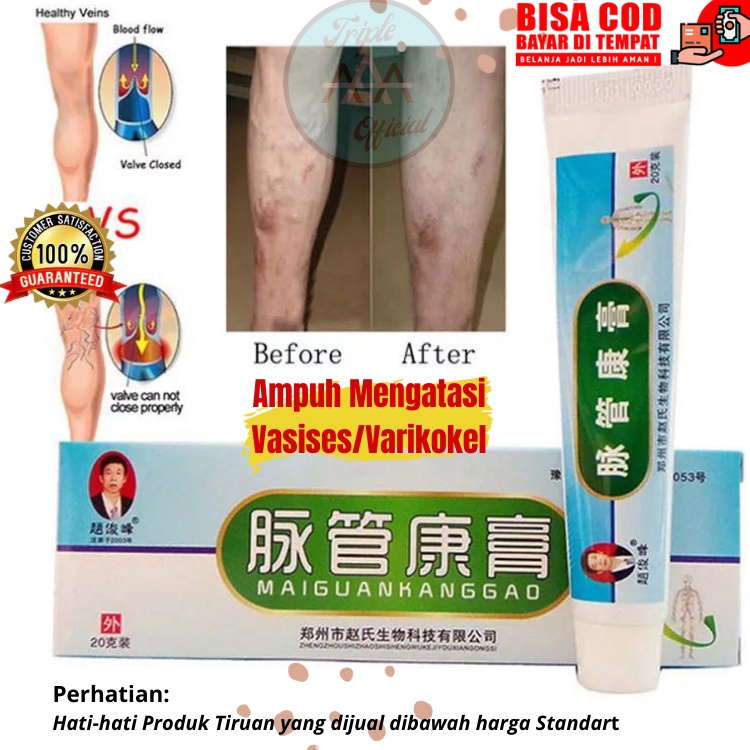 Jual TRIPLE A - Salep Varises Obat China Cina Maiguankanggao Original ...