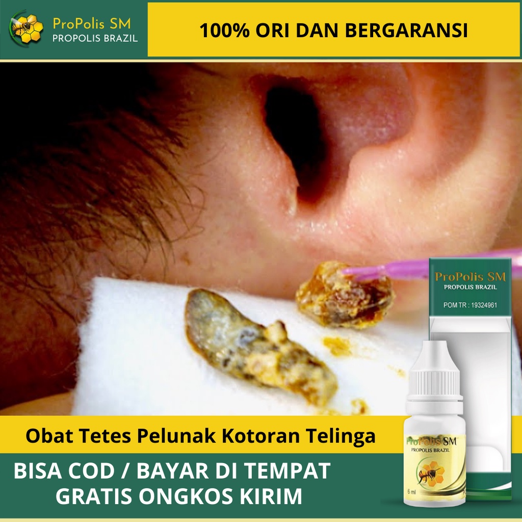 Jual Obat Tetes Pelunak Kotoran Telinga Keras, Obat Penghancur Kotoran ...