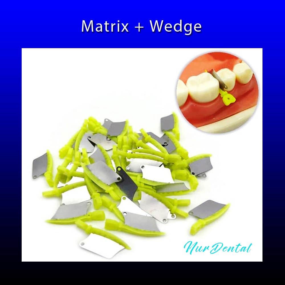 Jual Matrix vendermate wedge dental fendermate | Shopee Indonesia