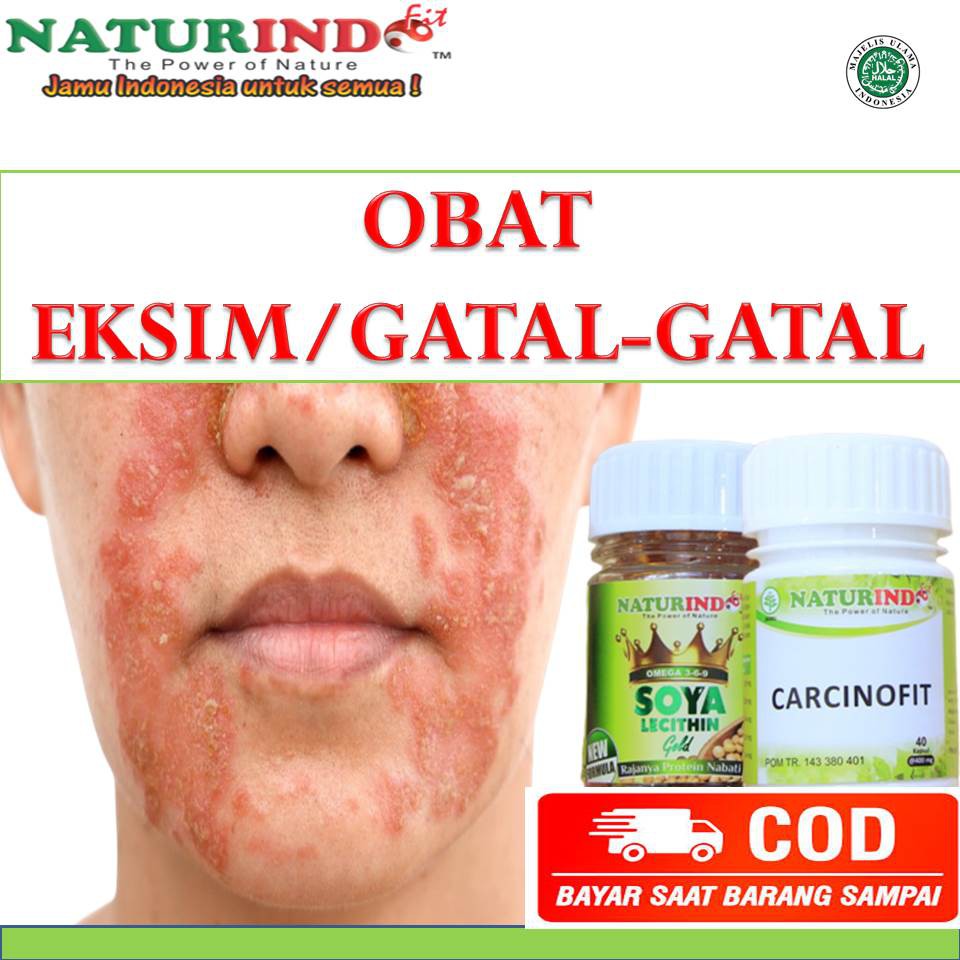 Jual Obat Eksim Gatal Gatal Sembuh Jamur Kulit Kudis Gudig Kurap Exim ...