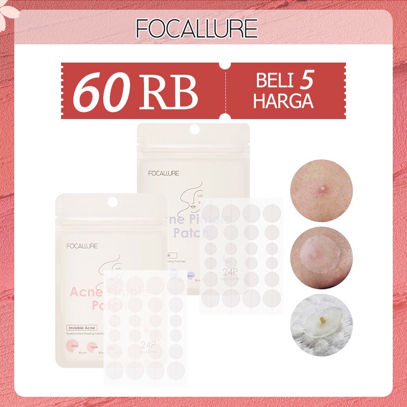 Jual FOCALLURE Spot Patch Acne Treatment Day/Night Skincare Acne ...