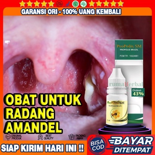 Jual Obat Radang Amandel, Amandel Bengkak, Radang Tonsil, Obat Amandel | Shopee Indonesia