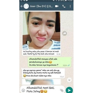 Jual ASLI Obat Mata Juling - Mata Tidak Sejajar - Strabismus - Mata ...