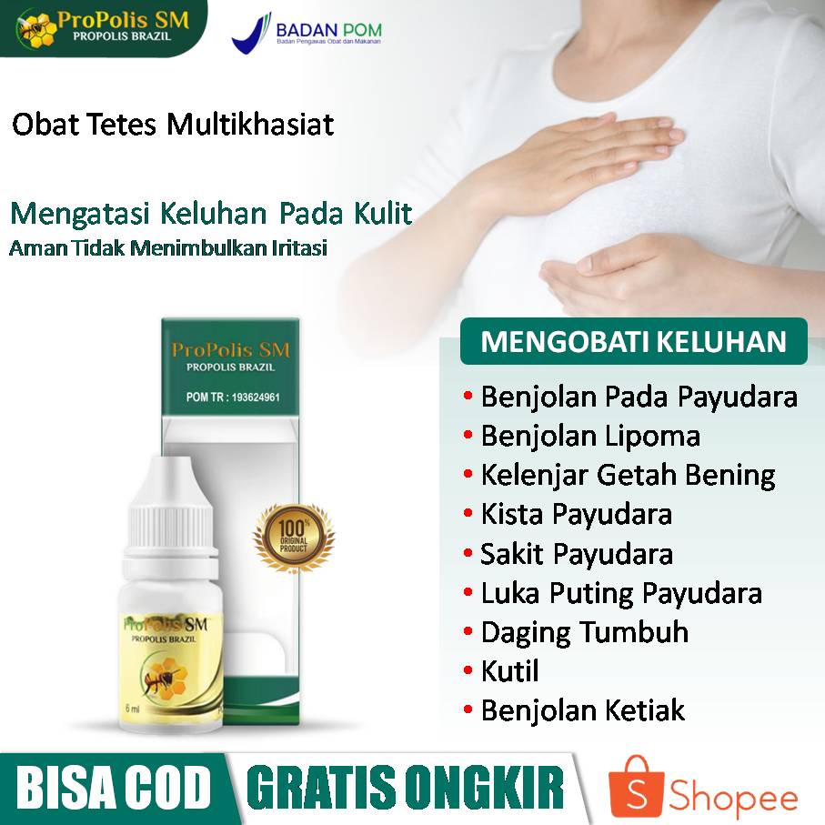 Jual Obat Oles Benjolan, Benjolan Di Payudara, Benjolan Lemak, Lipoma ...