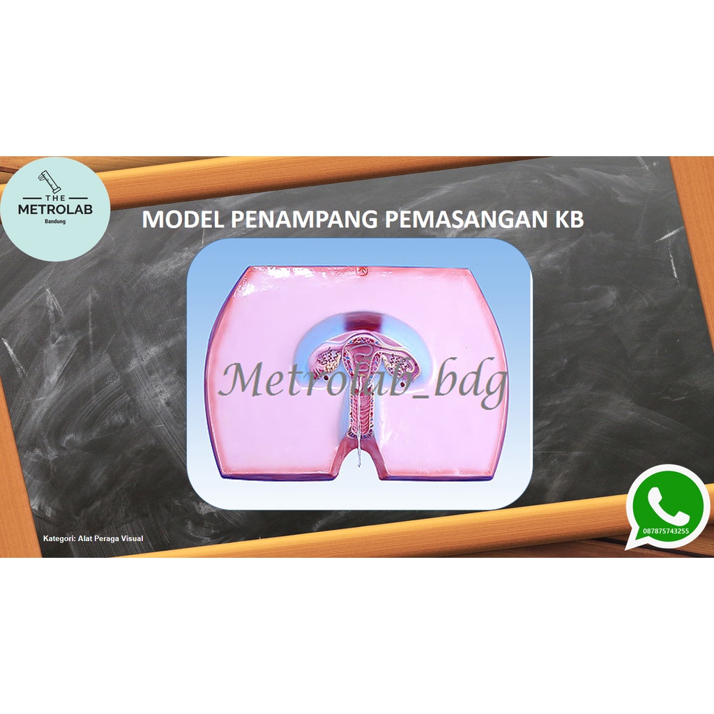 Jual Model Penampang Pemasangan Spiral Keluarga Berencana (KB) | Spiral ...