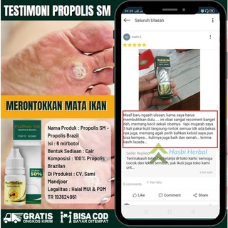 Jual [ BISA COD ] OBAT PERONTOK MATA IKAN / CLAVUS 100% ALAMI - OBAT ...