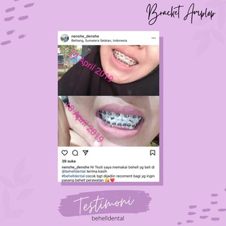Jual ORIGINAL Bracket Behel METAL Permanen amplop Murah / kawat dental ...