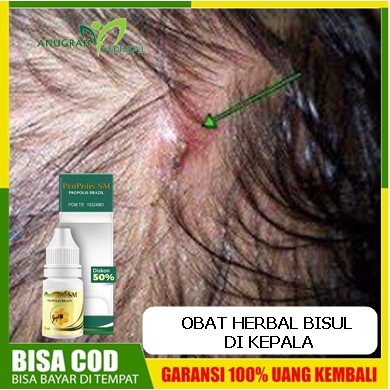 Jual Obat Bisul Di Kepala - Penghilang Pembengkakan Bisul Di Kepala ...