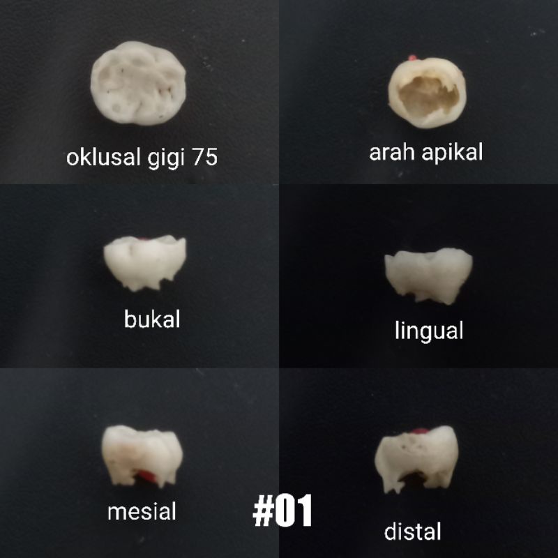 Jual Gigi Molar Anak 75 kode Praktikum | endo konservasi | Gigi untuk ...