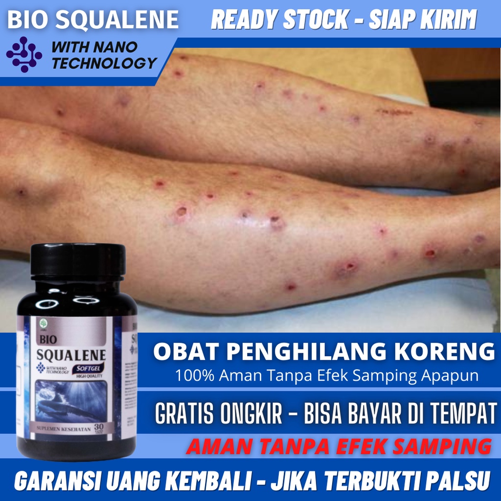 Jual Obat Penghilang Koreng dan Gatal, Korengan, Bekas Koreng, Koreng ...