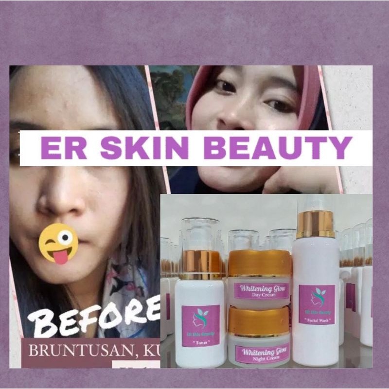 Jual Krim pemutih dan pelicin wajah racikan farmasi teraman dan ...