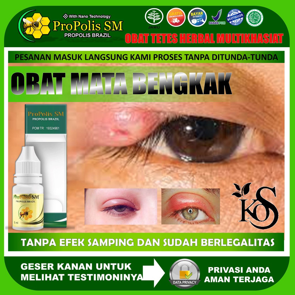 Jual Propolis Sm Brazil Obat Oles Mata Bengkak Bintitan Gede Sebelah ...