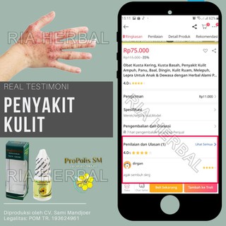 Jual OBAT GATAL DI KETIAK, JAMUR PADA KETEK AKIBAT PANU, EKSIM, INFEKSI ...