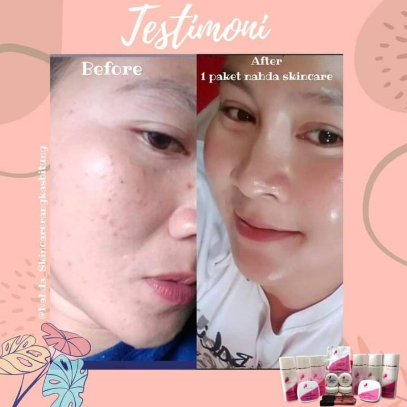 Jual NAHDA SKINCARE ORIGINAL | Shopee Indonesia Jual NAHDA SKINCARE ORIGINAL | Shopee Indonesia