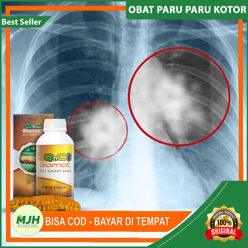 Jual Obat Pembersih Paru Paru Kotor - Flek Paru Paru - Infeksi Paru ...