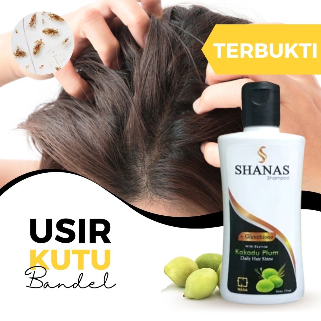 Jual SAMPO SANAS SHAMPO SHANAS OBAT KUTU RAMBUT AMPUH DAN TELUR KUTU ...