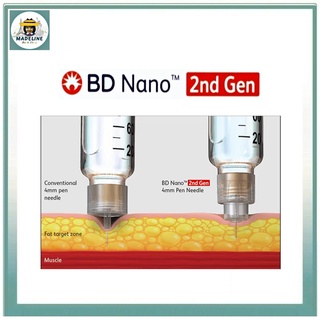 Jual BD Nano Ultra-Fine Pen Needles (Jarum Insulin) | Shopee Indonesia