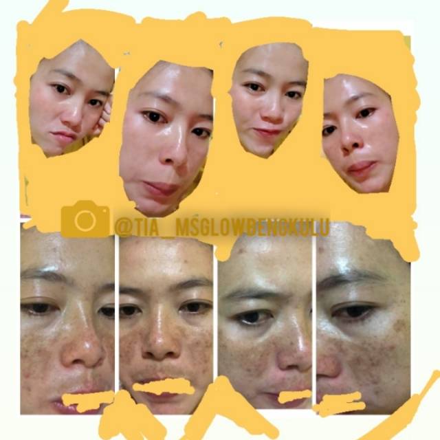 Jual paket ultimate ms glow real testi owner | Shopee Indonesia