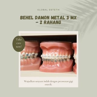 Jual Behel Damon Metal 3 MX 2 Rahang | Shopee Indonesia