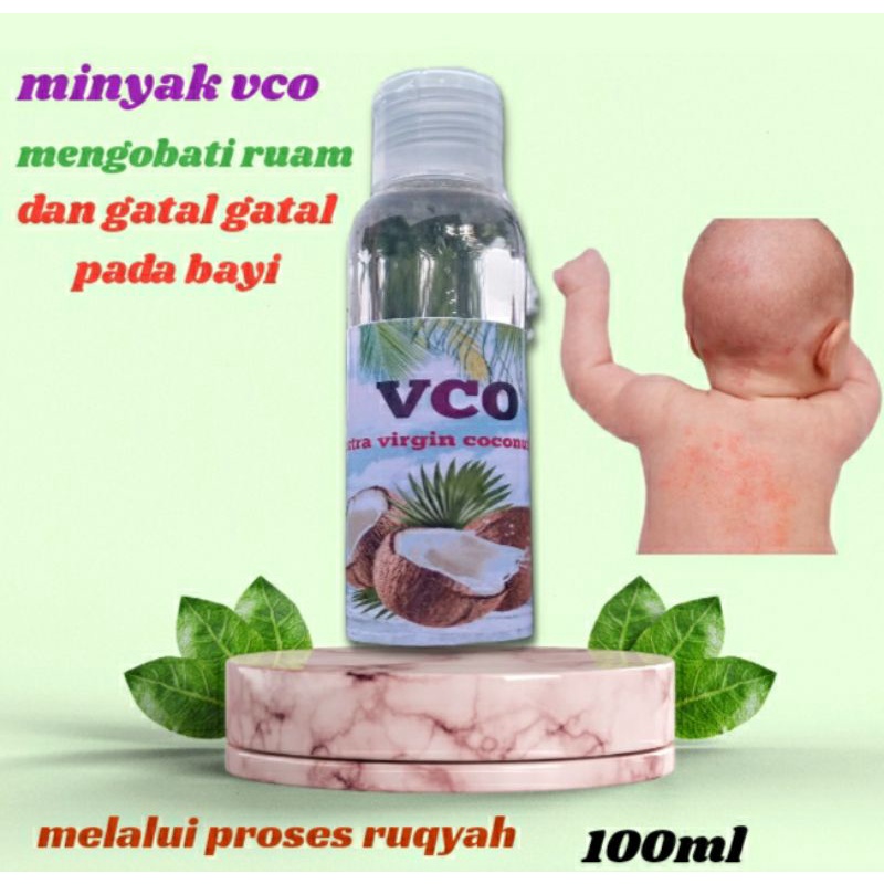 Jual MINYAK VCO RUAM GATAL PADA BAYI DAN ANAK ANAK | Shopee Indonesia