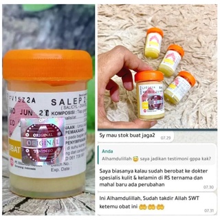 Jual Salep zwafel 24 Obat Salep Gatal Paling Ampuh Gatel Kulit Panu ...
