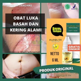 Jual Obat Luka Agar Cepat Kering Bernanah - Pengering Luka Basah ...