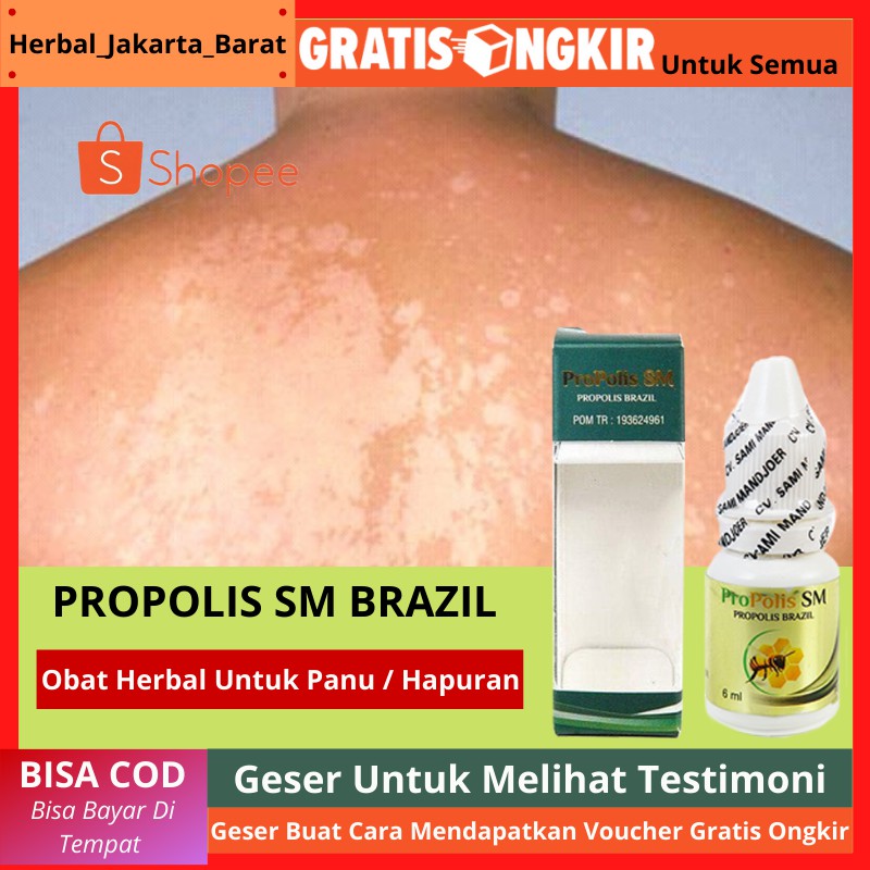 Jual Obat Jamur Panuan, Penghilang Hapur Mengelupas Susah Sembuh, Panu ...