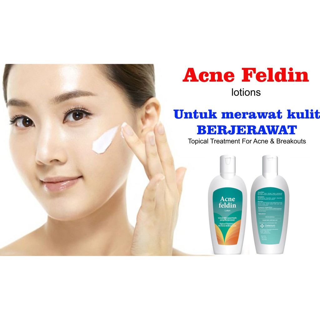 Jual Acne Feldin Lotion 110 ML (Lotion ANTI Jerawat) wajah menjadi ...