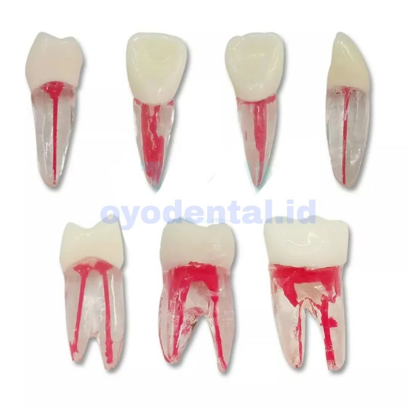 Jual Dental artificial teeth endodontic / model gigi endodontik saluran ...