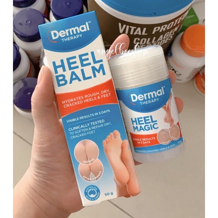 Jual (READY) dermal therapy - heel magic / heel balm SPORE | Shopee ...
