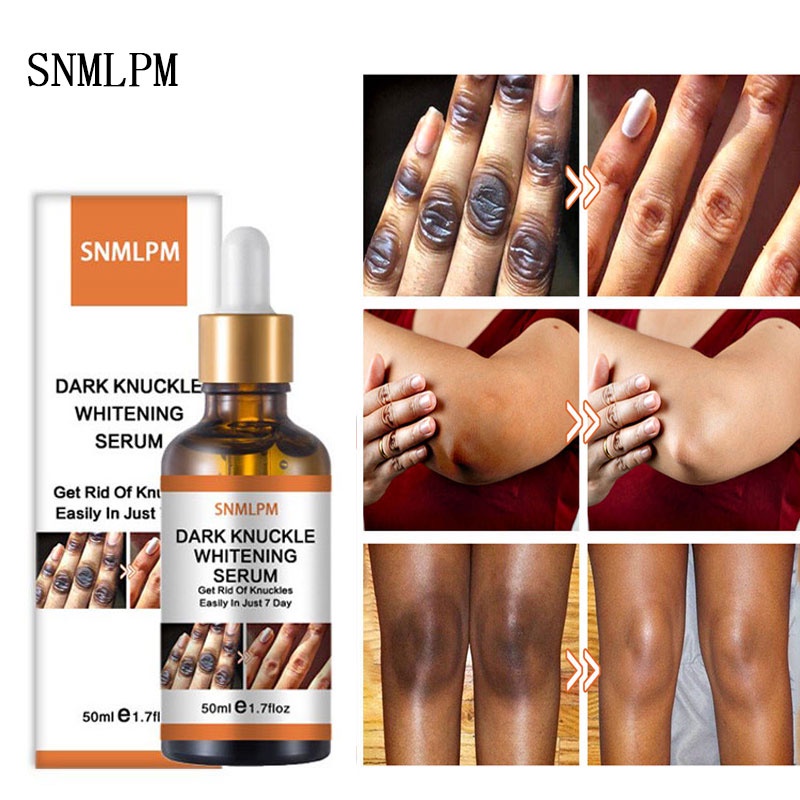 Jual Joint De-blackening Beauty Serum Dark Knuckles Knee Ankle Corner ... Jual Joint De-blackening Beauty Serum Dark Knuckles Knee Ankle Corner ...