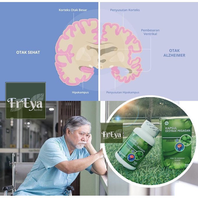 Jual OBAT ALZHEIMER, OBAT HERBAL PIKUN, OBAT PELUPA, OBAT SERING LUPA ...