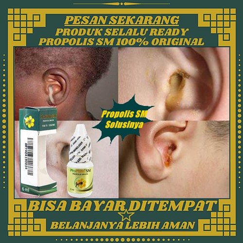 Jual Propolis SM Obat Telinga Berair Bau, Congek Menahun, Curek, Conge ...