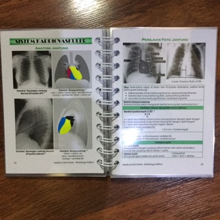 Jual Medical Mini Notes RADIOLOGY - Buku Saku Kedokteran Indonesia ...