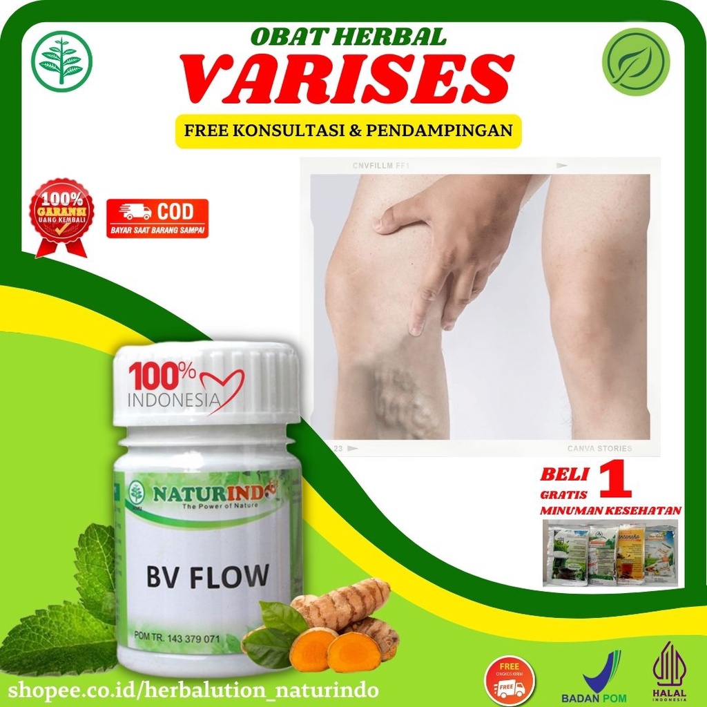 Jual Obat Varises Di Kaki Dan Betis Paling Ampuh Obat Varikokel Bv Flow ...