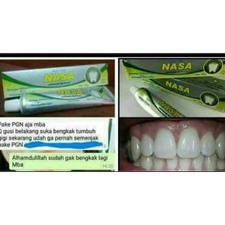 Jual Pasta gigi/odol nasa 120gr-PGN NASA (MERONTOKAN KARANG GIGI ...
