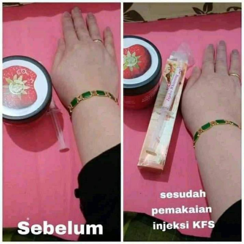 Jual Injeksi Whitening KFS 1box isi 2 injeksi Indonesia|Shopee Indonesia