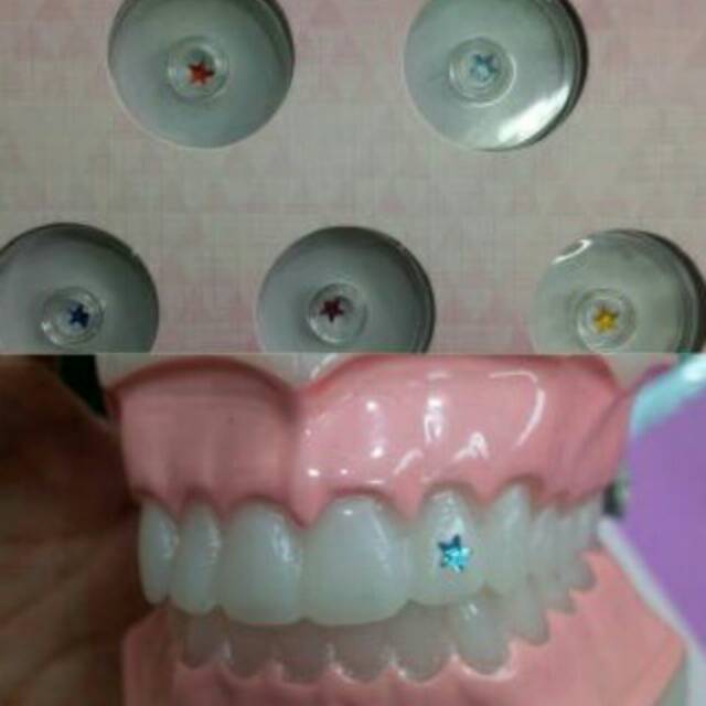 Jual Diamond gigi | Shopee Indonesia